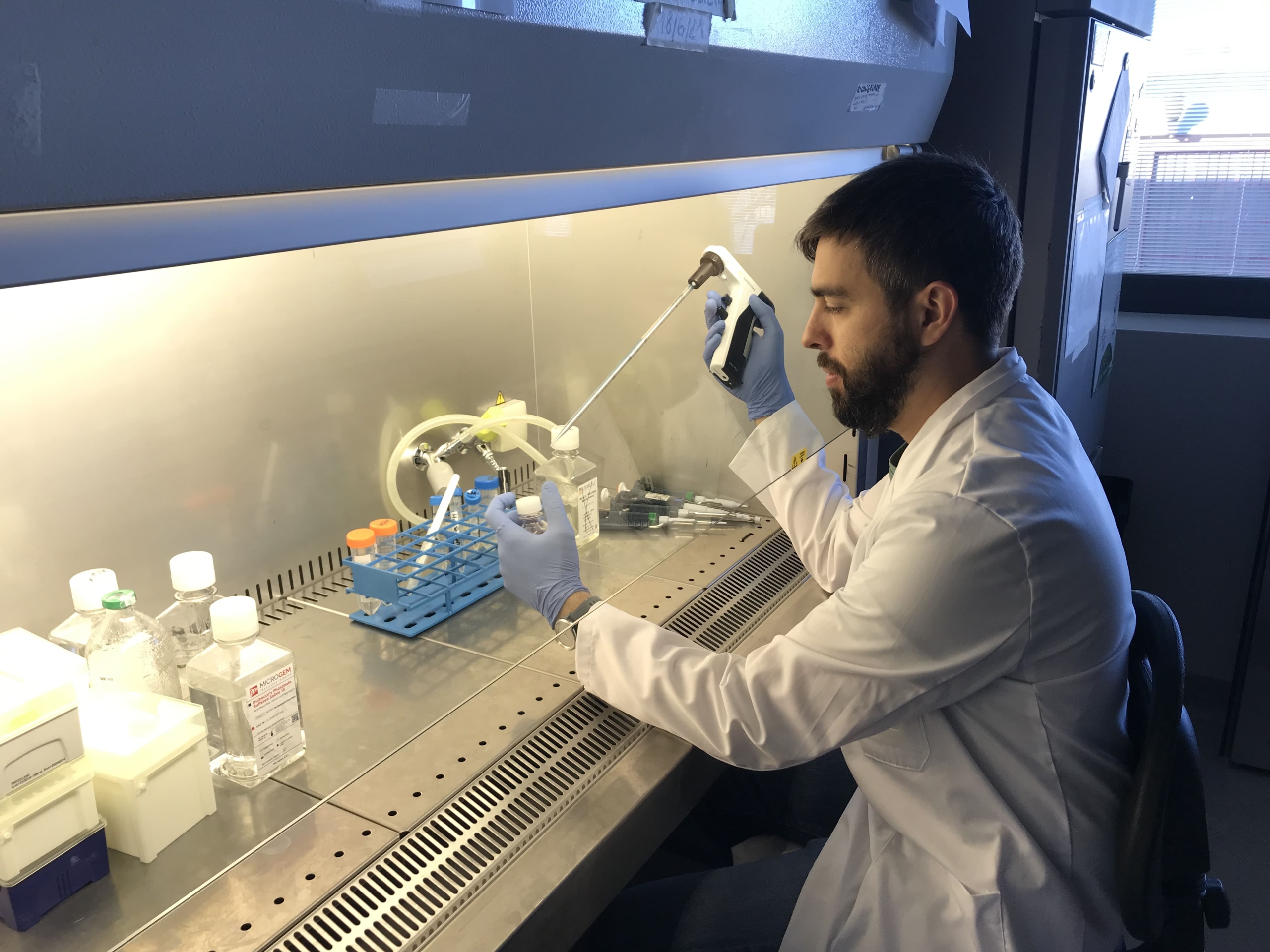 Glioblastoma: una navetta per trasportare i farmaci con precisione